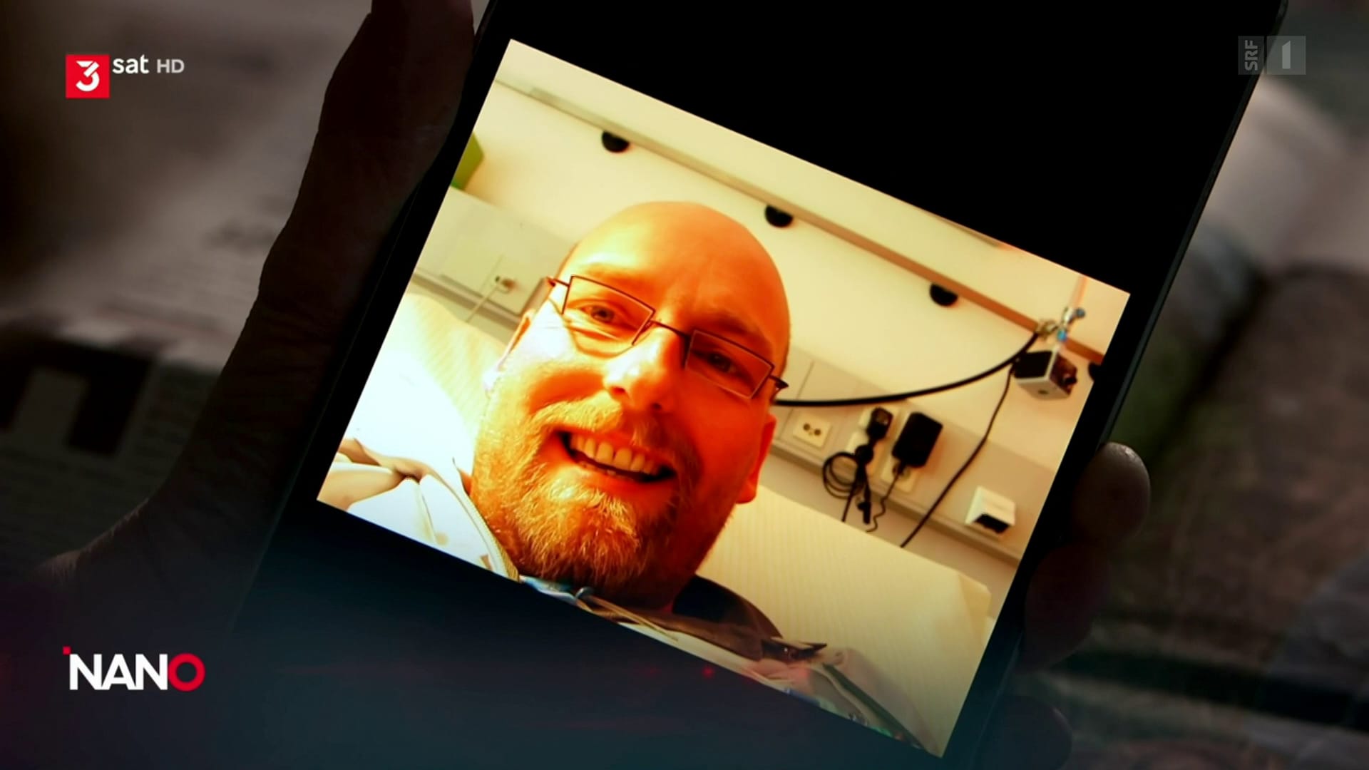 Leukämie und HIV-Heilung nach Stammzelltransplantation - nano - Play SRF