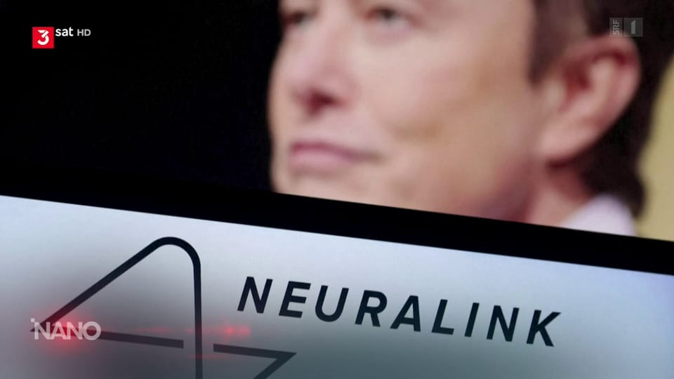 Hirn-Computer-Schnittstellen - nano - Play SRF