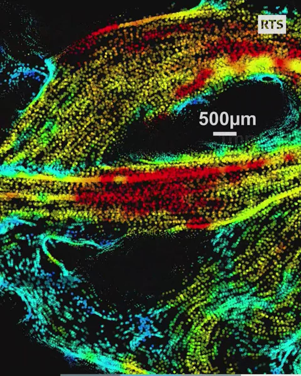 36.9° - Une nouvelle technique d'imagerie pour voir les flux sanguins ...